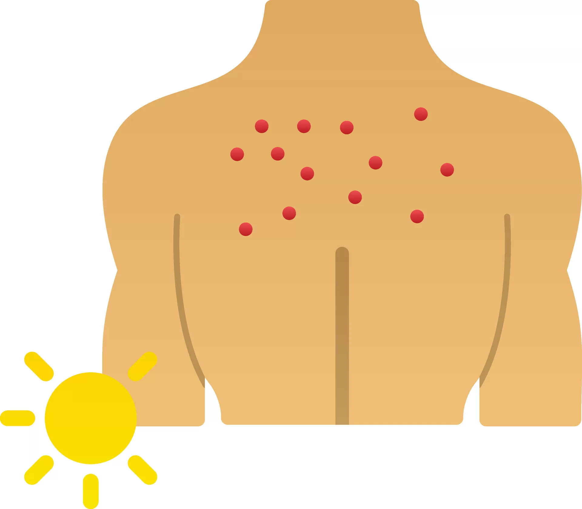 Shingles On The Chest Proven Facts The Antidote
